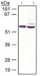 RPE65 Antibody (MA1-16578)