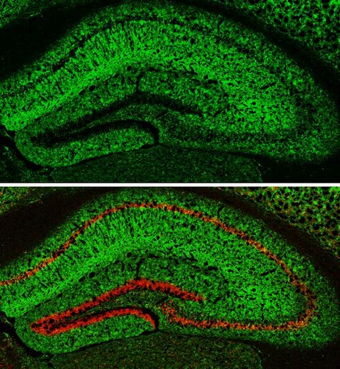 MAP2 Antibody (MA1-25043)