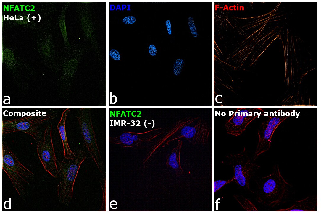 NFATC2 Antibody (MA1-025)