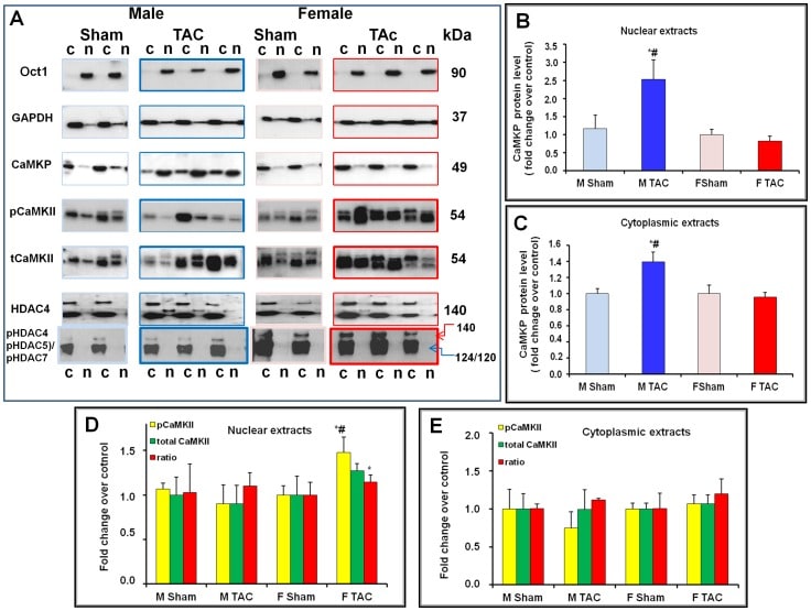 Phospho-CaMKII alpha (Thr286) Antibody (MA1-047)