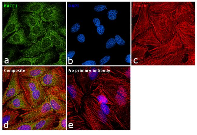BACE1 Antibody (MA1-177)