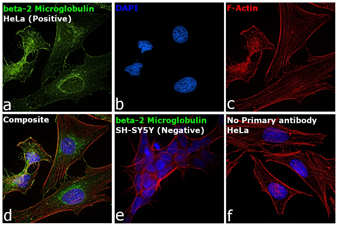 beta-2 Microglobulin Antibody (MA1-19413)