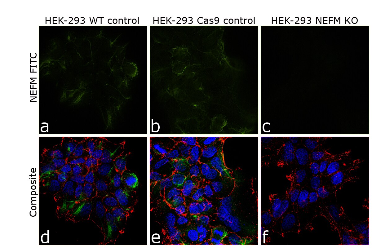 NEFM Antibody (MA1-2011)