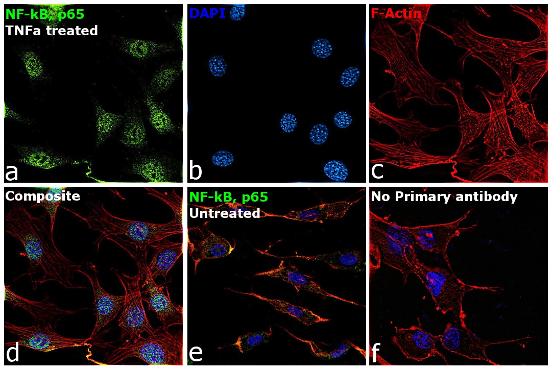NFkB p65 Antibody (MA1-24691)