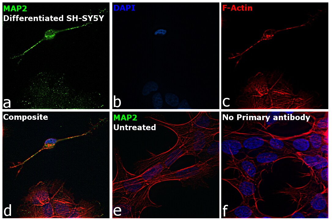 MAP2 Antibody (MA1-25043)