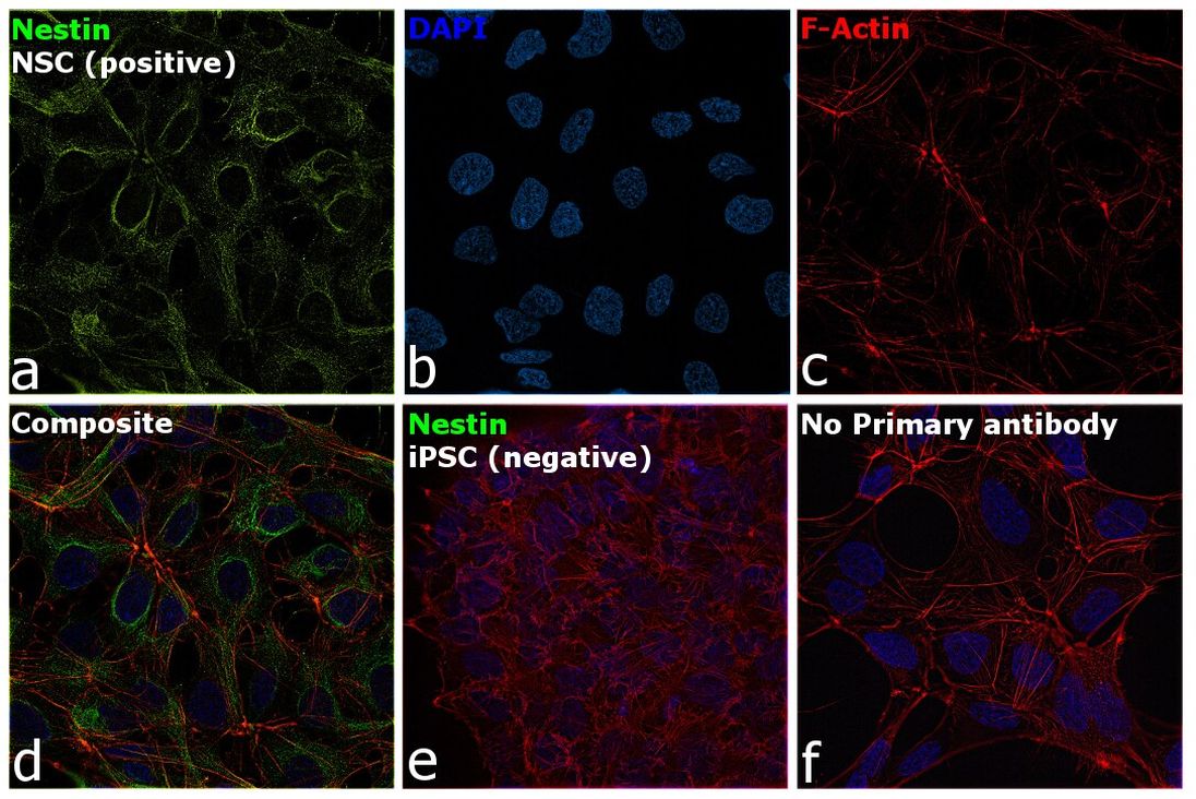 Nestin Antibody (MA1-26777)