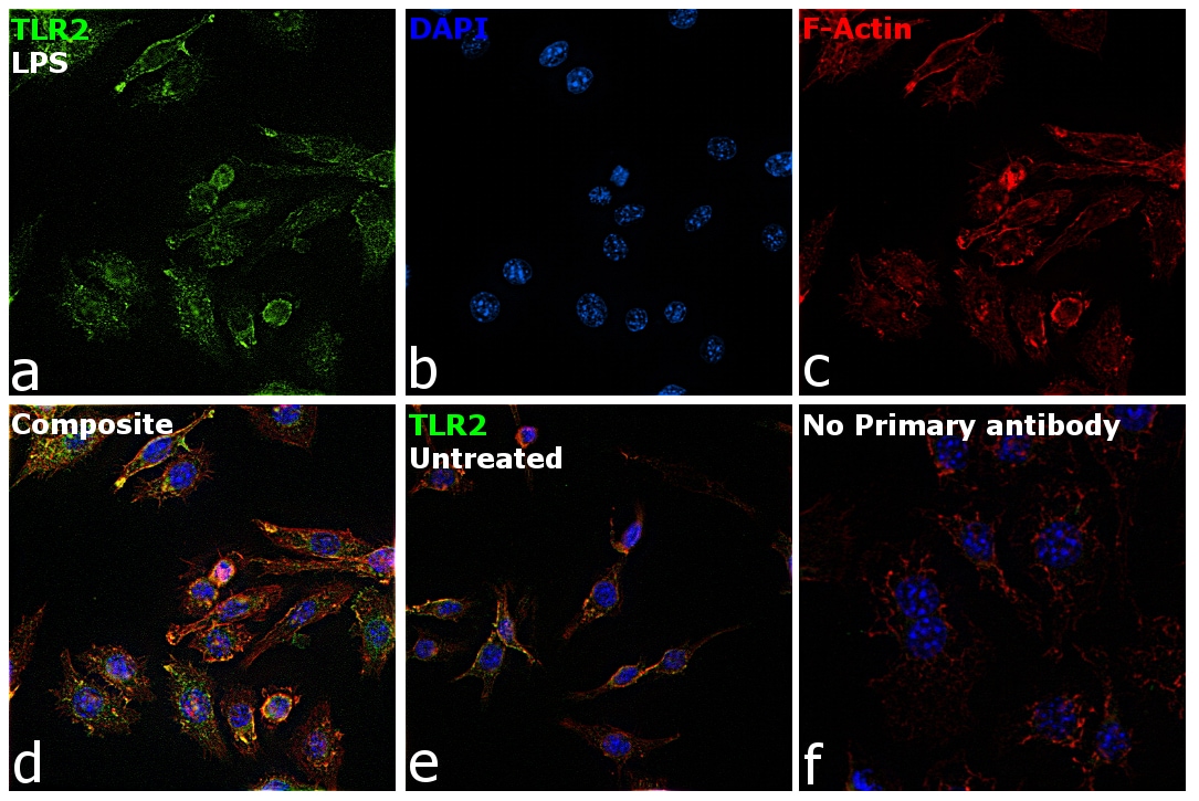 TLR2 Antibody (MA1-40048)
