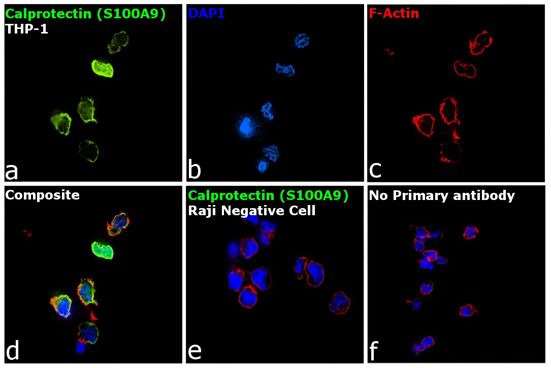 Calprotectin Antibody (MA1-81381)