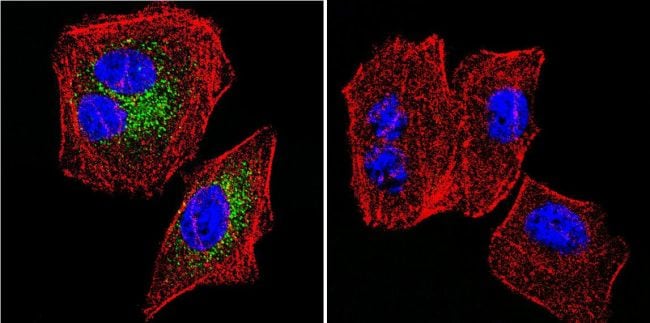 SERCA2 ATPase Antibody (MA3-919)
