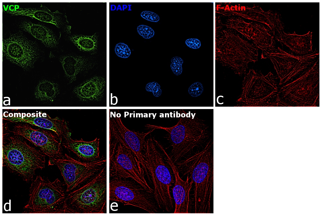 VCP Antibody (MA3-004)