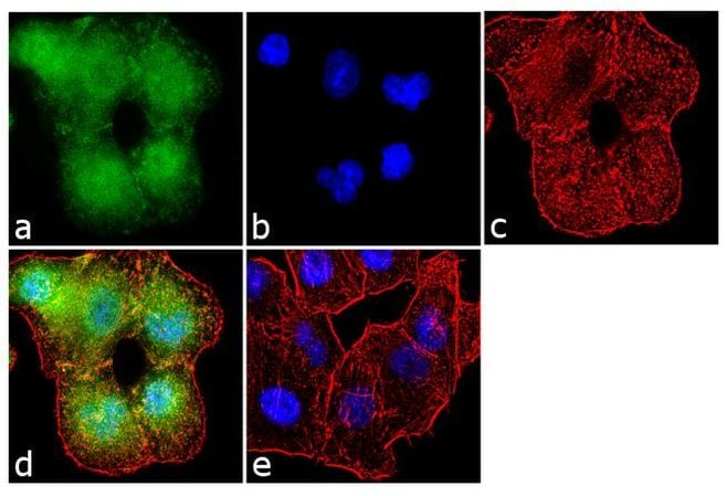 Aggrecan Antibody (MA3-16888)