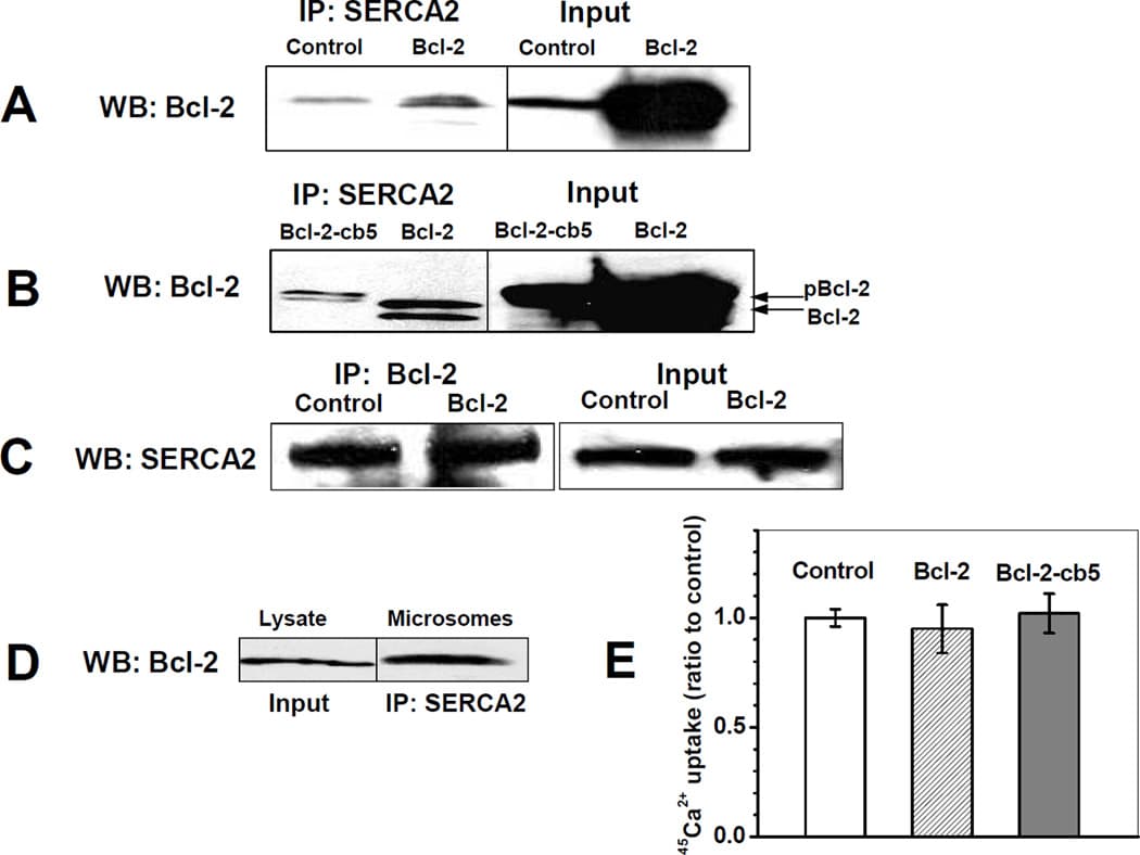 SERCA2 ATPase Antibody (MA3-910)