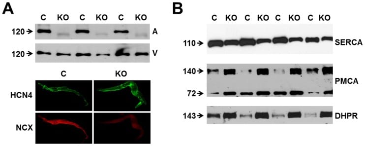 CACNA2D1 Antibody (MA3-921)