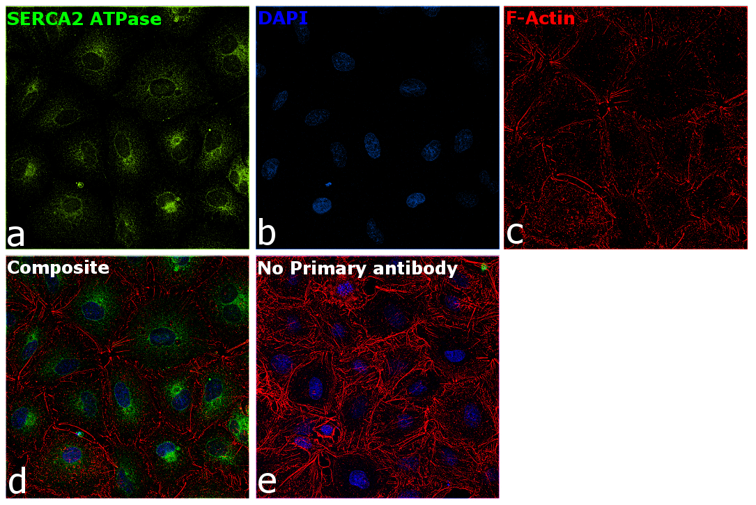 SERCA2 ATPase Antibody (MA3-919)