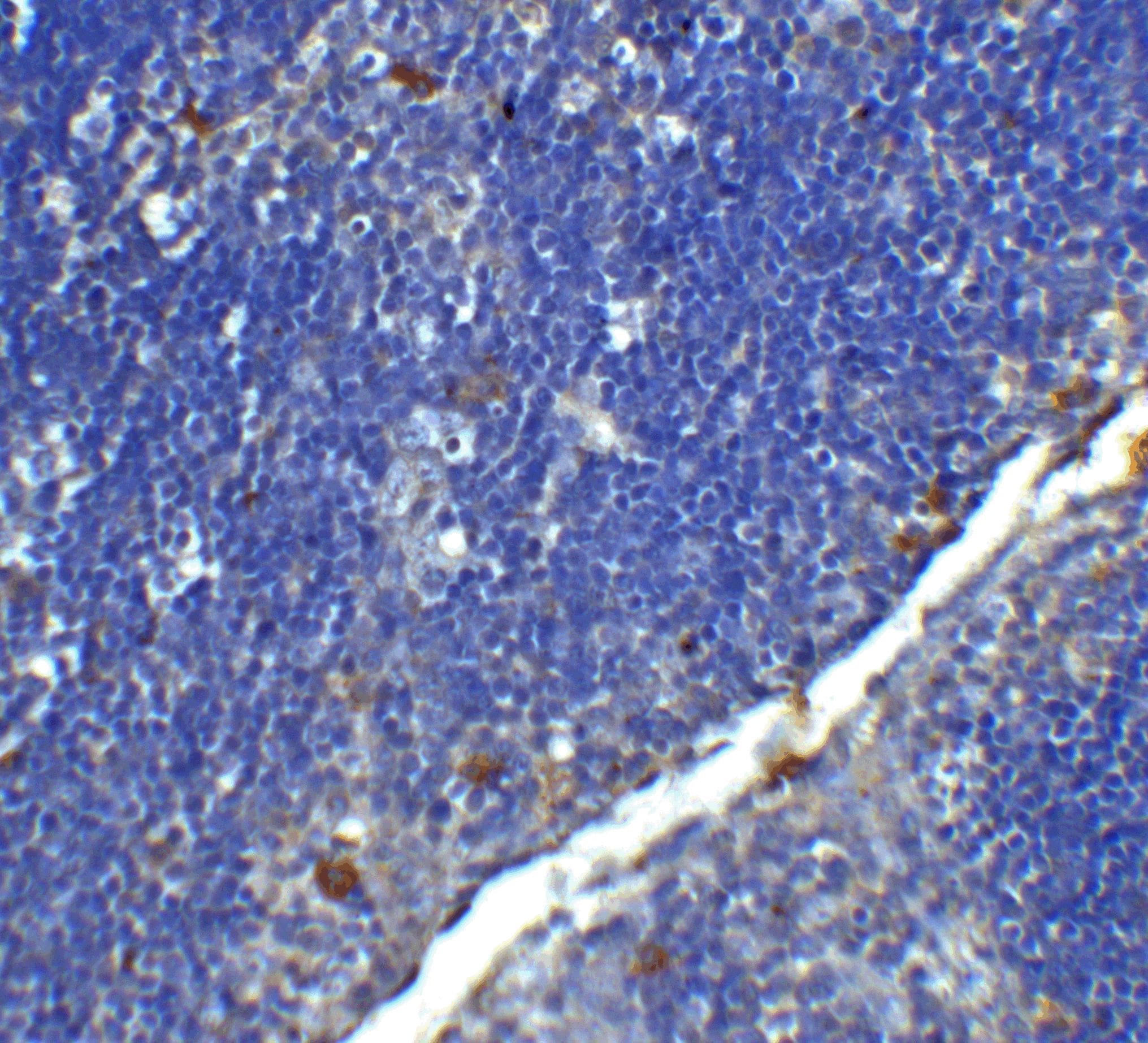 CD4 Antibody (MA5-15774)