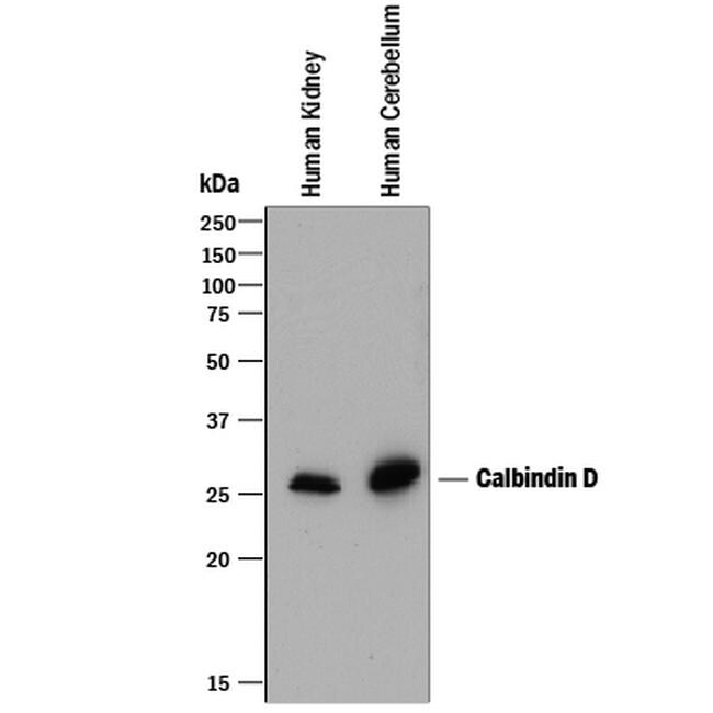 Calbindin D28K Antibody (MA5-24135)