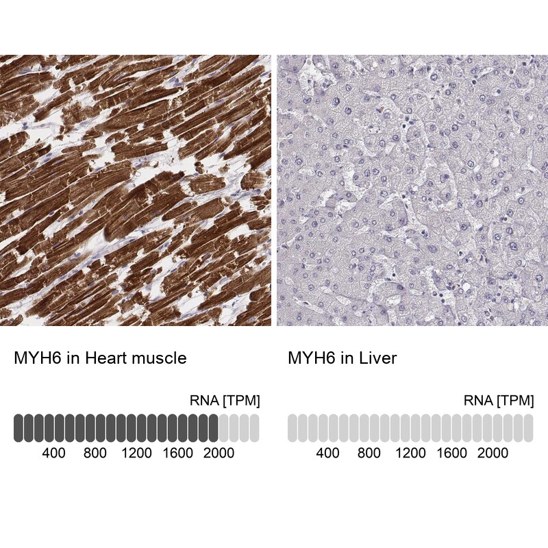 MYH6 Antibody (MA5-24631)