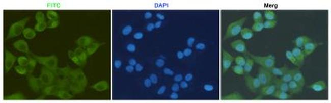 S100A10 Antibody (MA5-24769)