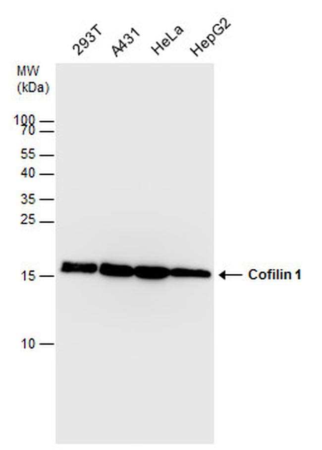 Cofilin Antibody (MA5-27737)