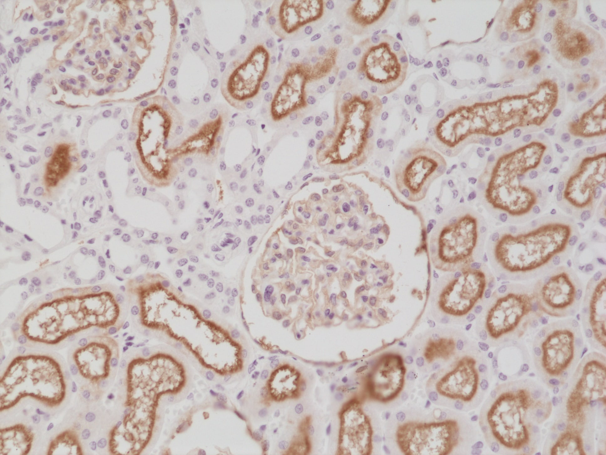 CD10 Antibody (MA5-27893)