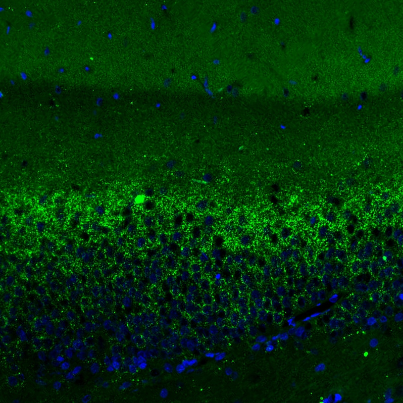 VGLUT2 Antibody (MA5-31378)
