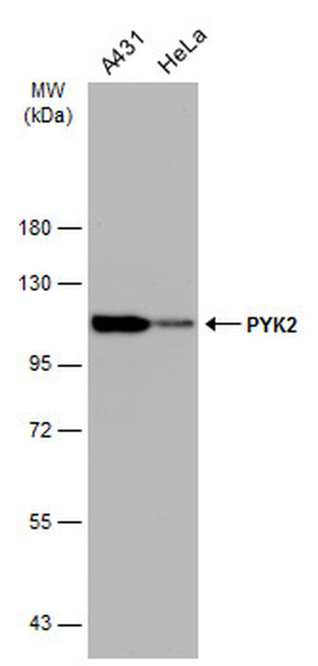 PYK2 Antibody (MA5-31573)