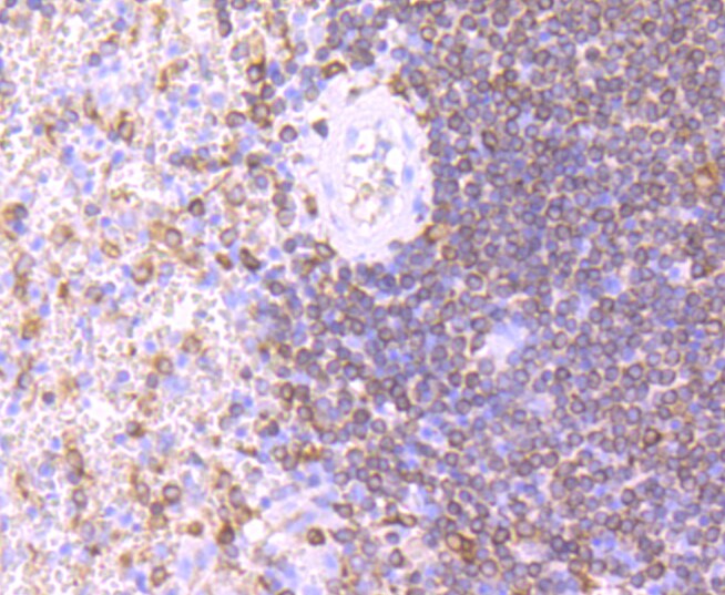 CD74 Antibody (MA5-32529)