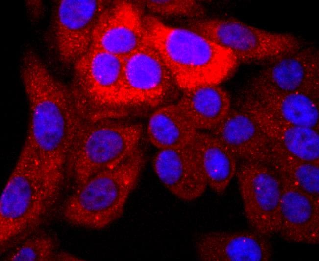 S100P Antibody (MA5-32550)