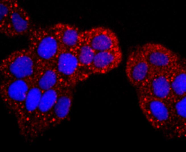 S100P Antibody (MA5-32550)