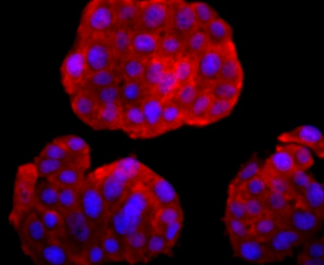 PGP9.5 Antibody (MA5-32583)