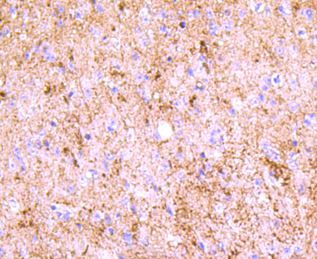 PGP9.5 Antibody (MA5-32583)