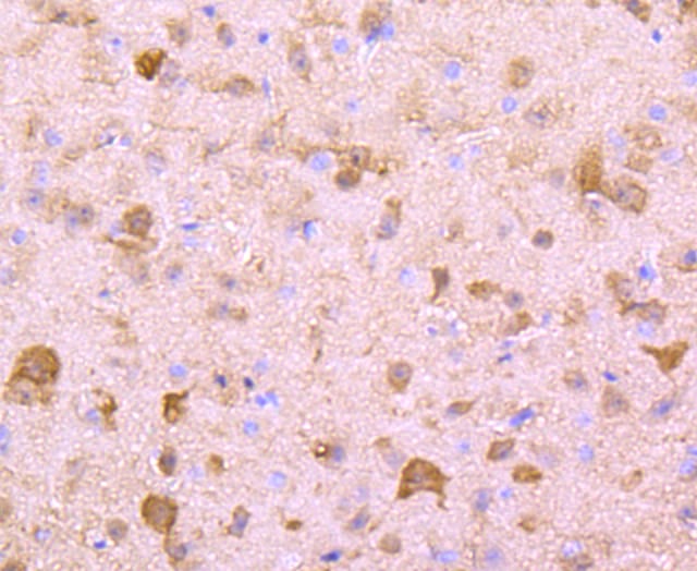 PGP9.5 Antibody (MA5-32583)