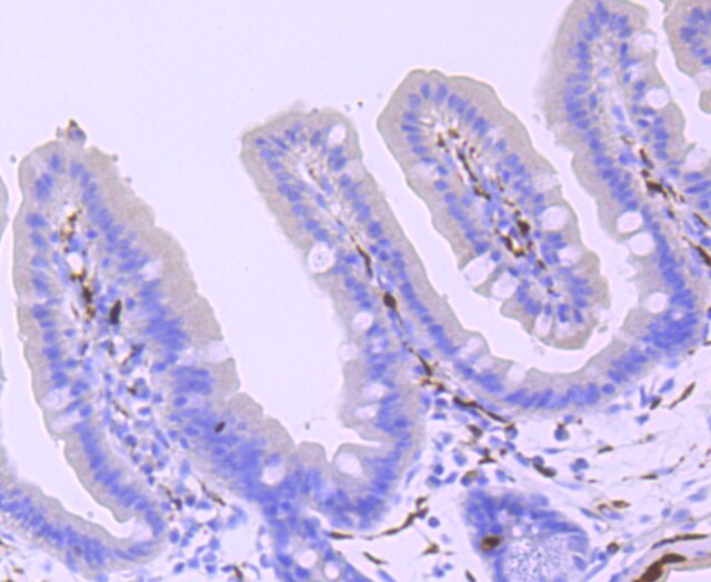 PGP9.5 Antibody (MA5-32583)