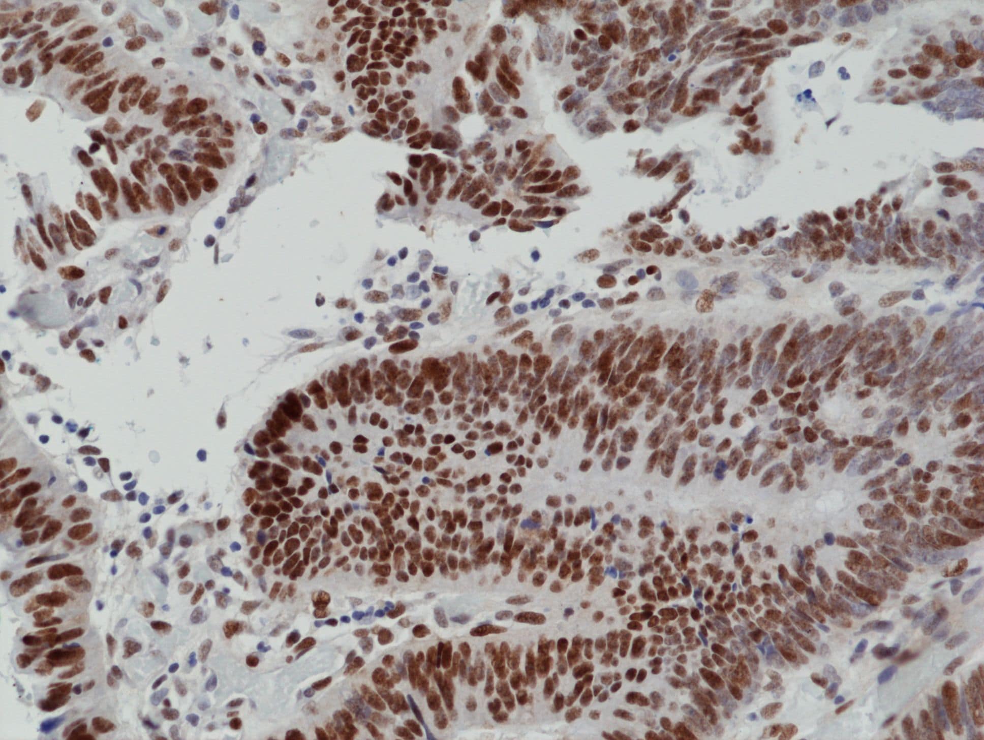 MSH6 Antibody (MA5-33076)