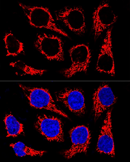 TOM20 Antibody (MA5-34964)