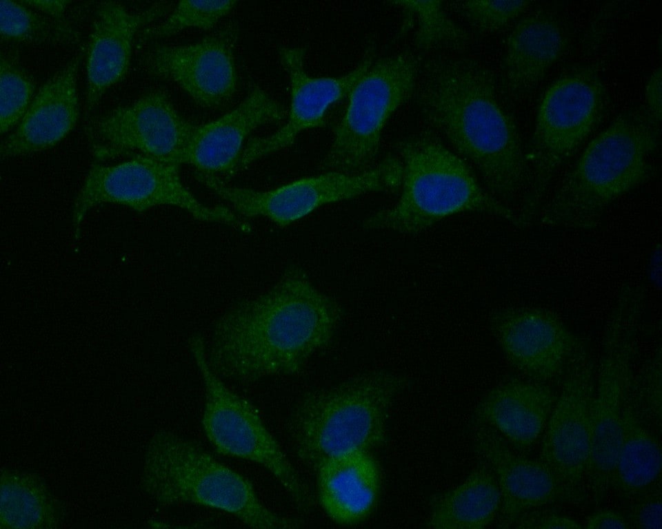 P4HB Antibody (MA5-36205)
