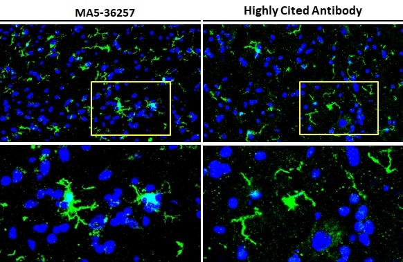 IBA1 Antibody (MA5-36257)