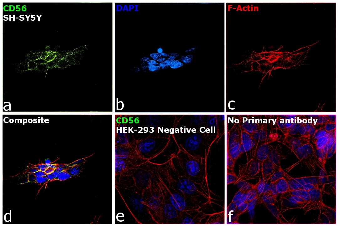 CD56 Antibody (MA5-11563)