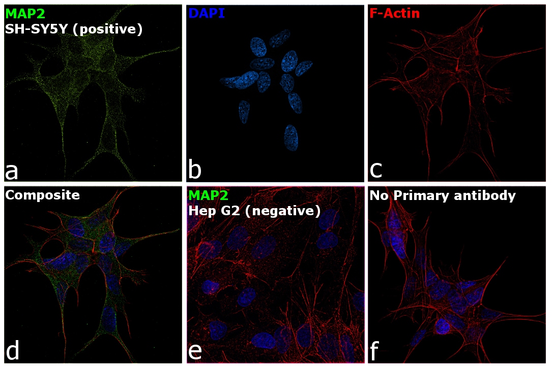 MAP2 Antibody (MA5-12826)