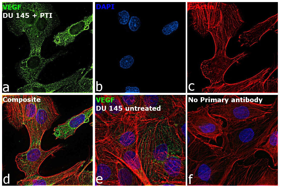 VEGF Antibody (MA5-13182)