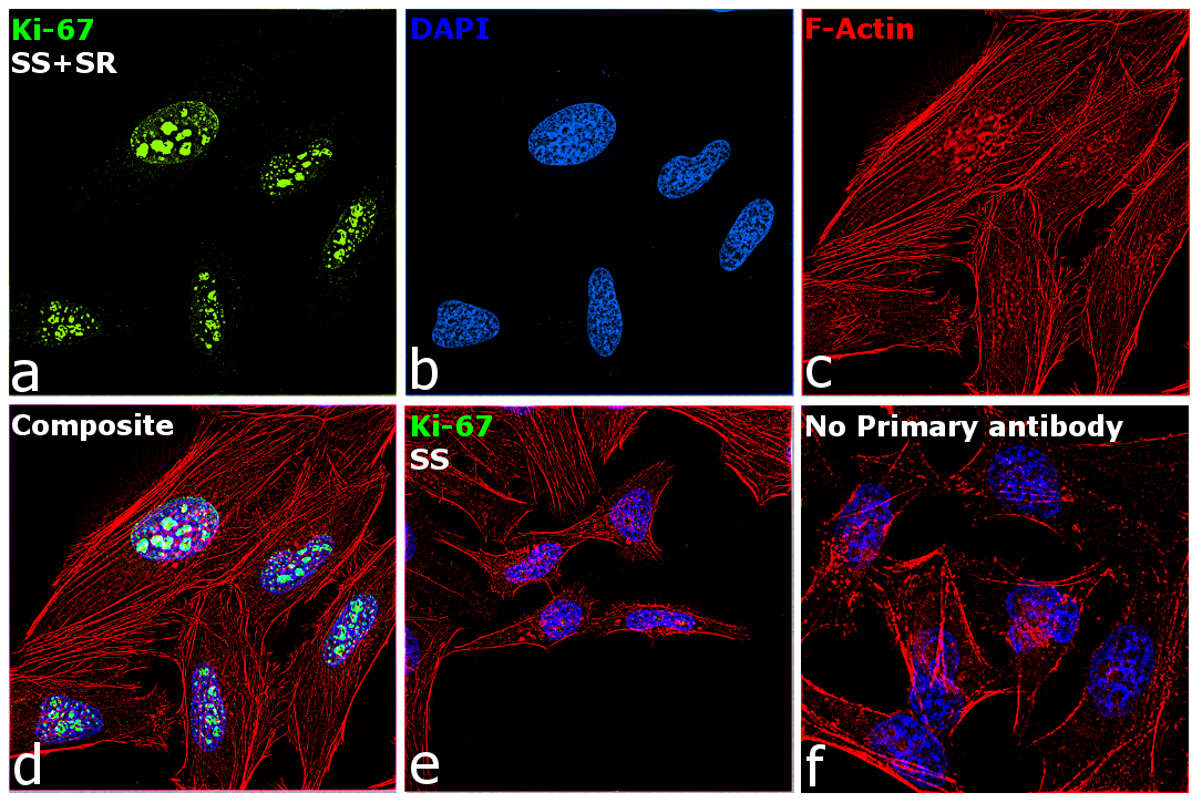 Ki-67 Antibody (MA5-14520)