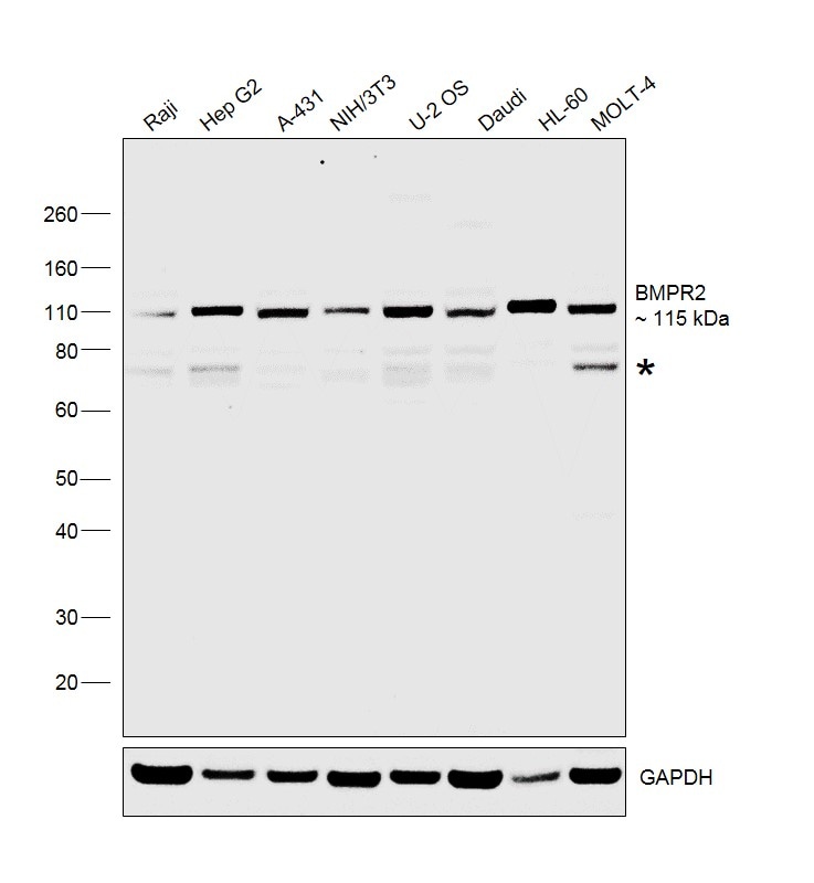 BMPR2 Antibody (MA5-15827)