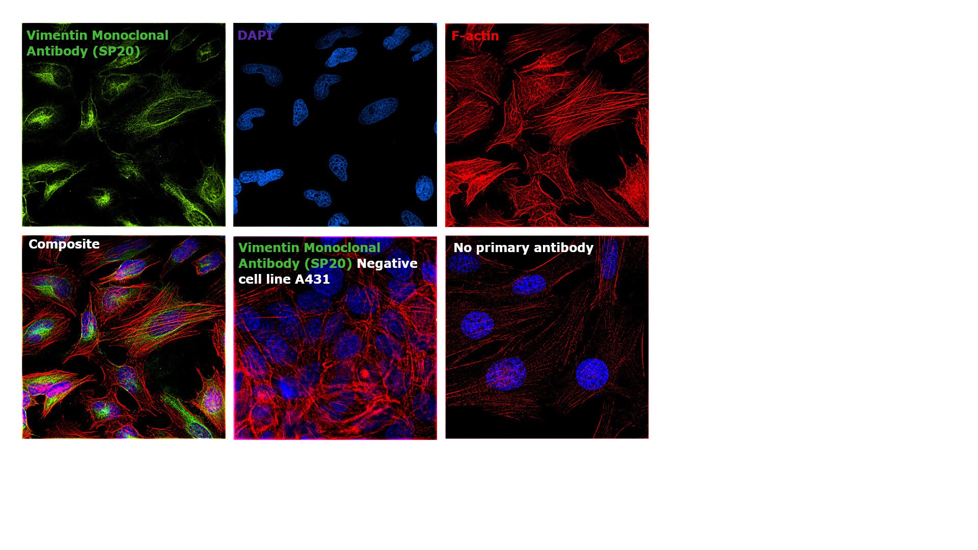 Vimentin Antibody (MA5-16409)