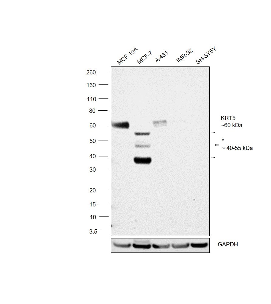 Cytokeratin 5 Antibody (MA5-17057)