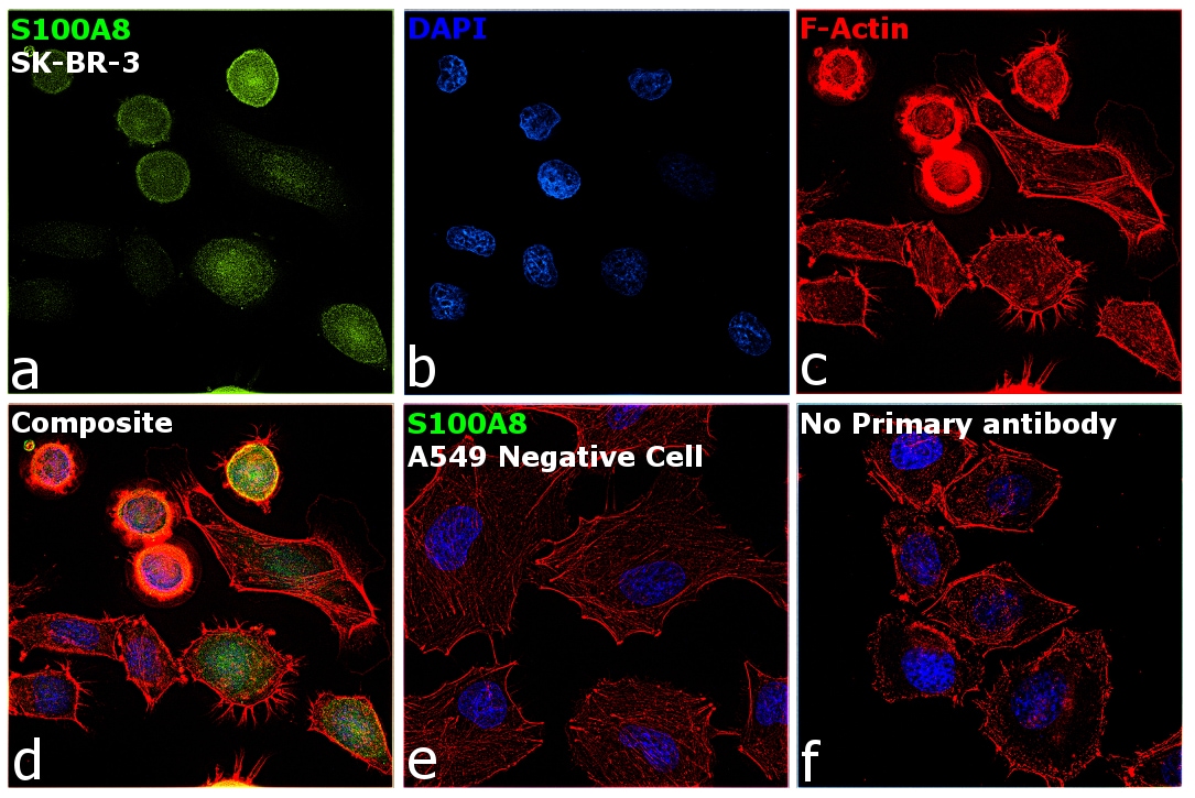 S100A8 Antibody (MA5-17621)