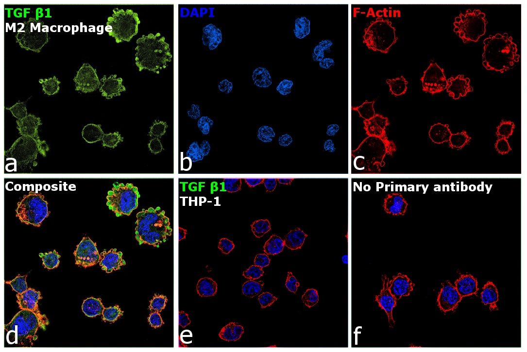 TGF beta-1 Antibody (MA5-18023)