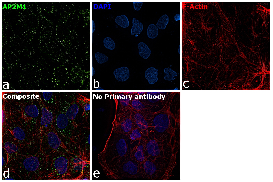 AP2M1 Antibody (MA5-25570)