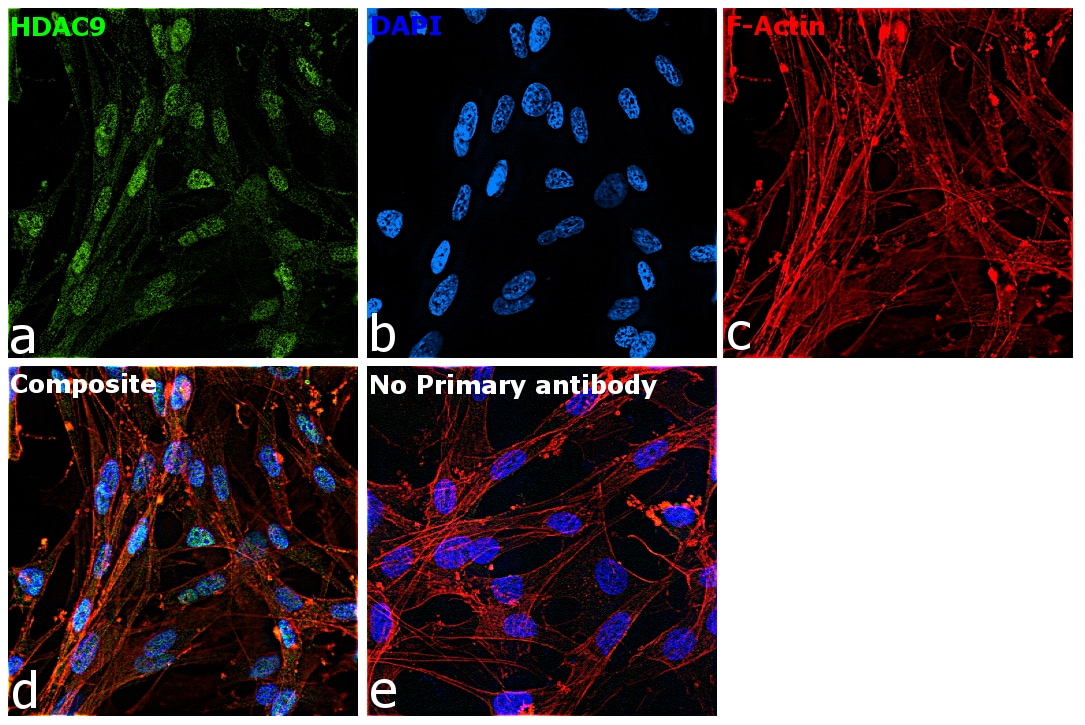 HDAC9 Antibody (MA5-26729)