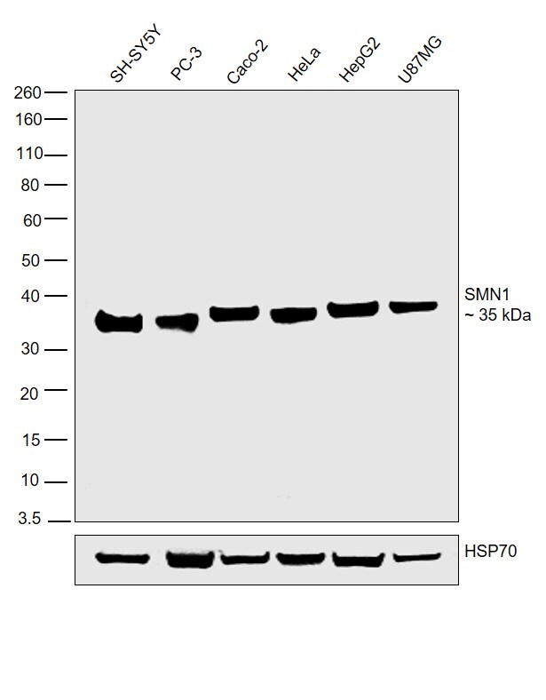 SMN1/SMN2 Antibody (MA5-27878)