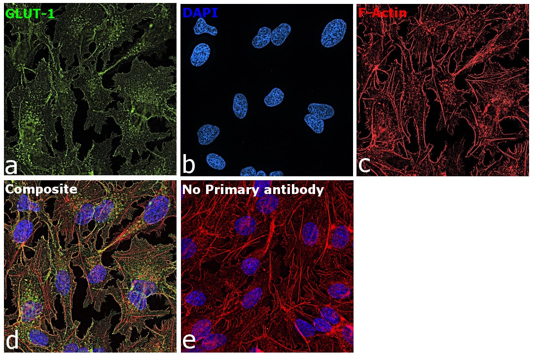 GLUT1 Antibody (MA5-31960)